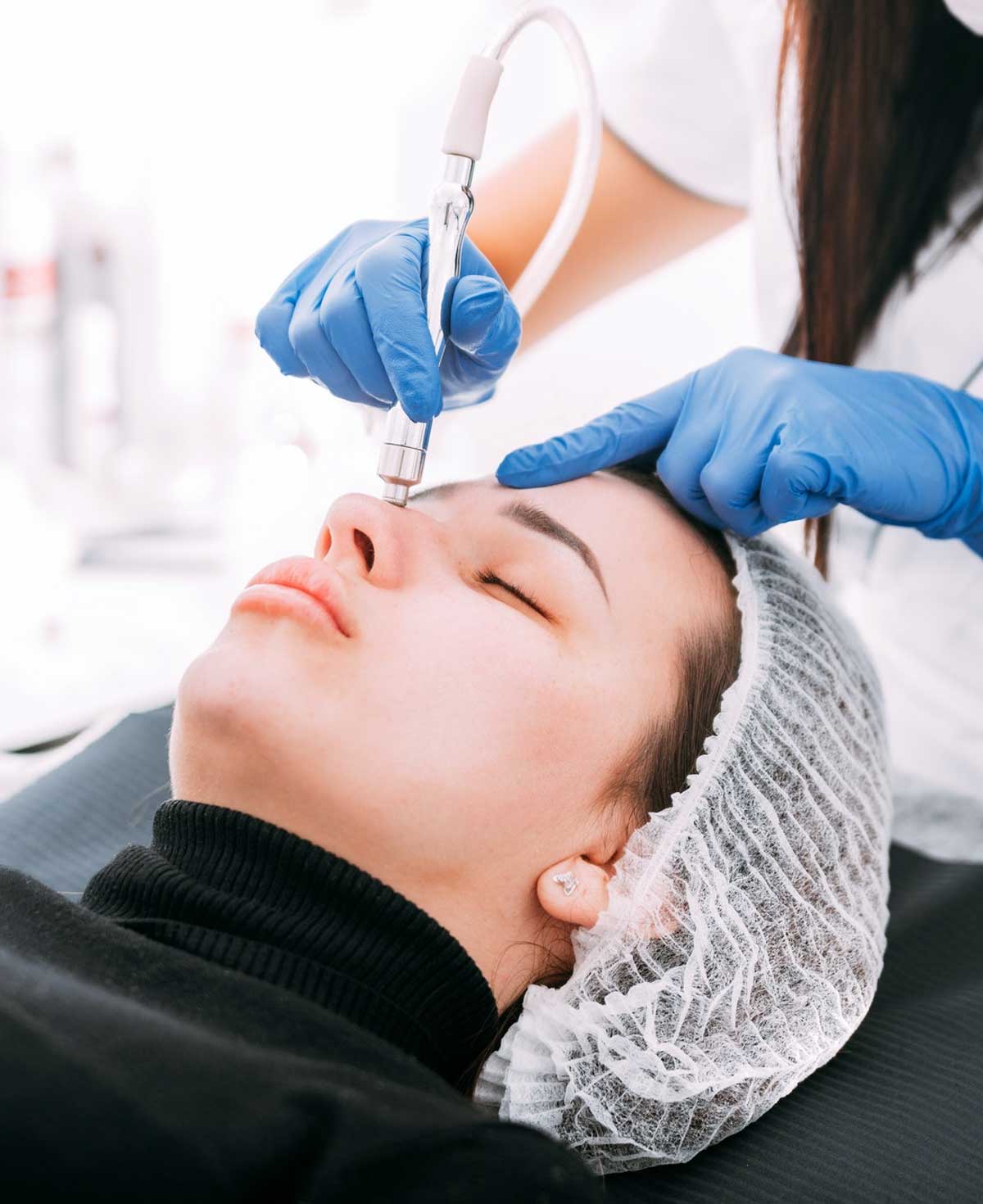 Δερμοαπόξεση Προσώπου | My Laser Clinic